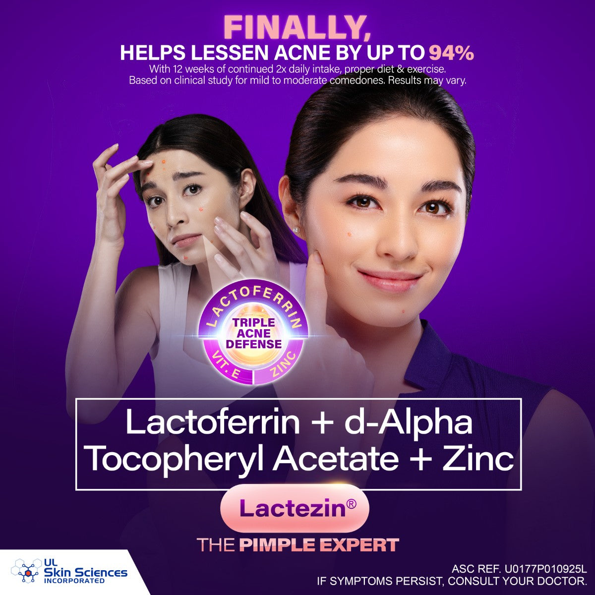Lactezin Anti-Acne 100mg 28 Capsules – UL Skin Sciences, Inc.